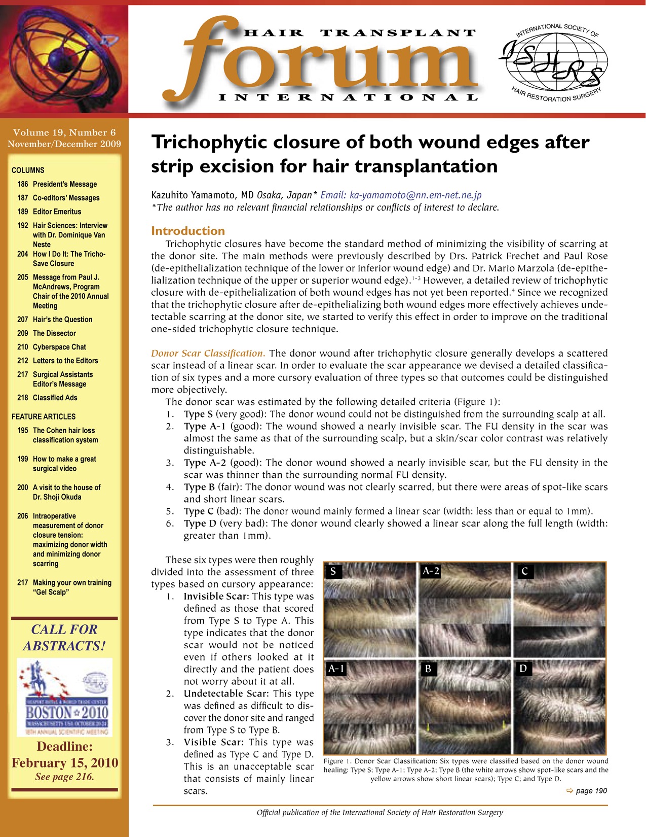 Hair’s the Question“?”: Female Pattern Hair Loss (FPHL) | Hair ...